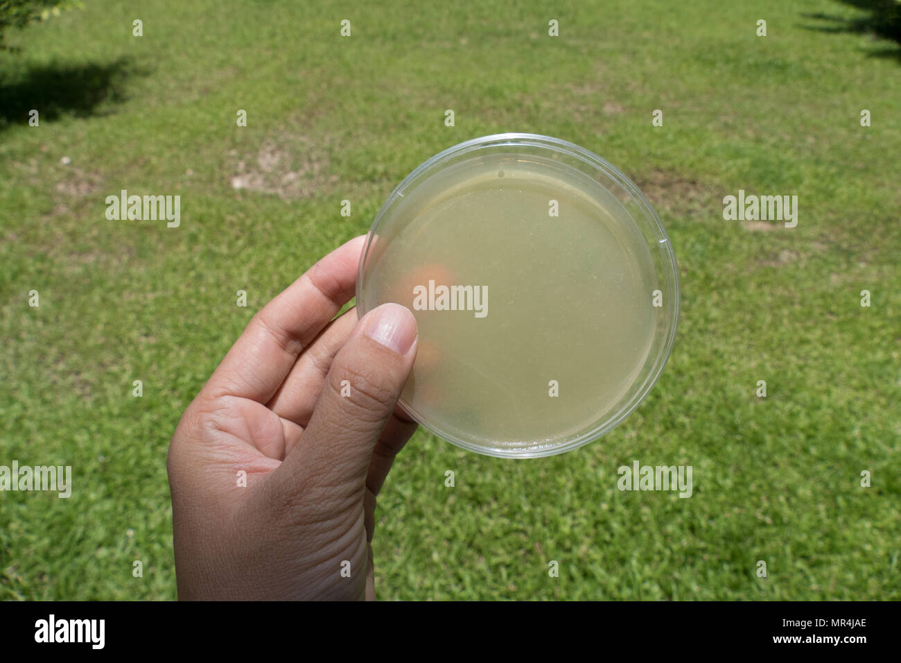 Contamination microbienne Banque de photographies et d’images à haute ...