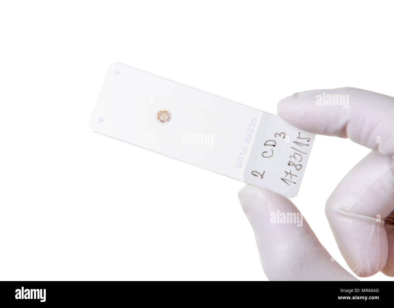 Lame de microscope Banque de photographies et d’images à haute ...