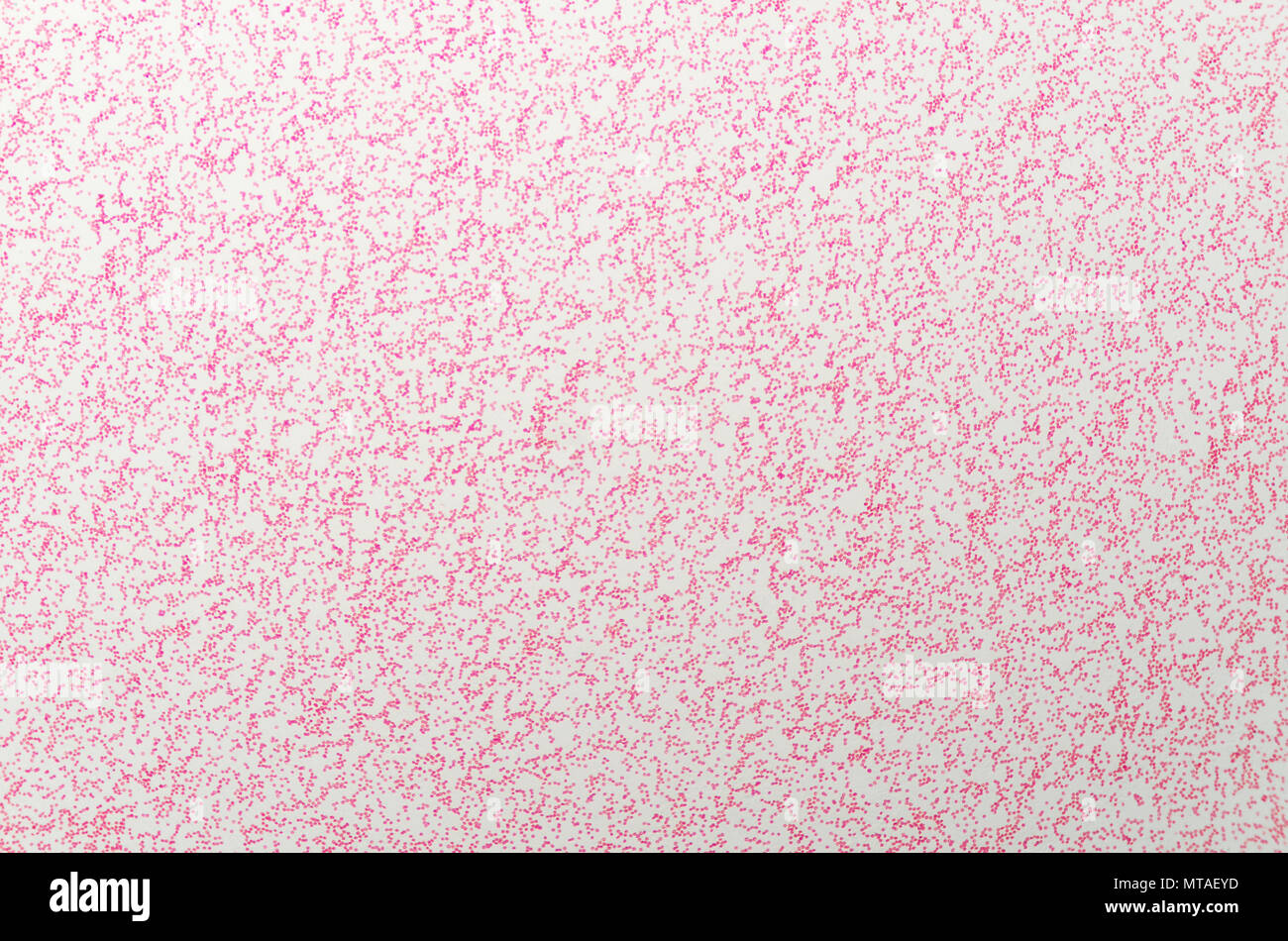 Les globules rouges humains amplifiés sous microscope. Enduire de ...