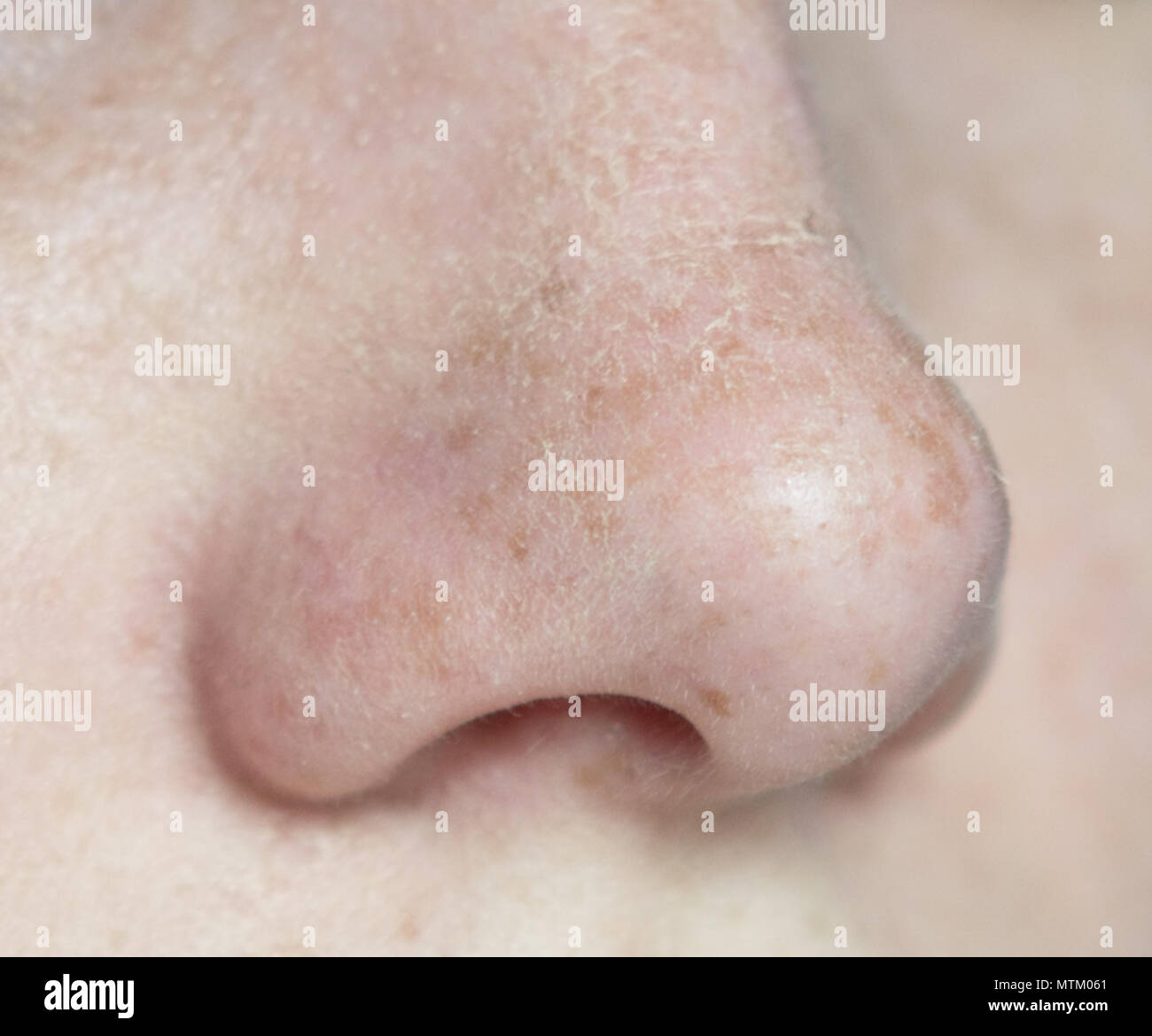 Nez humain Banque de photographies et d’images à haute résolution - Alamy