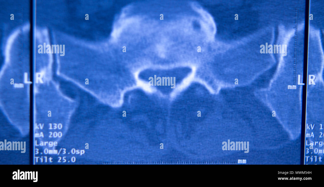 X-ray hôpital médical rachis bassin hanches traumatologie IRM scan ...