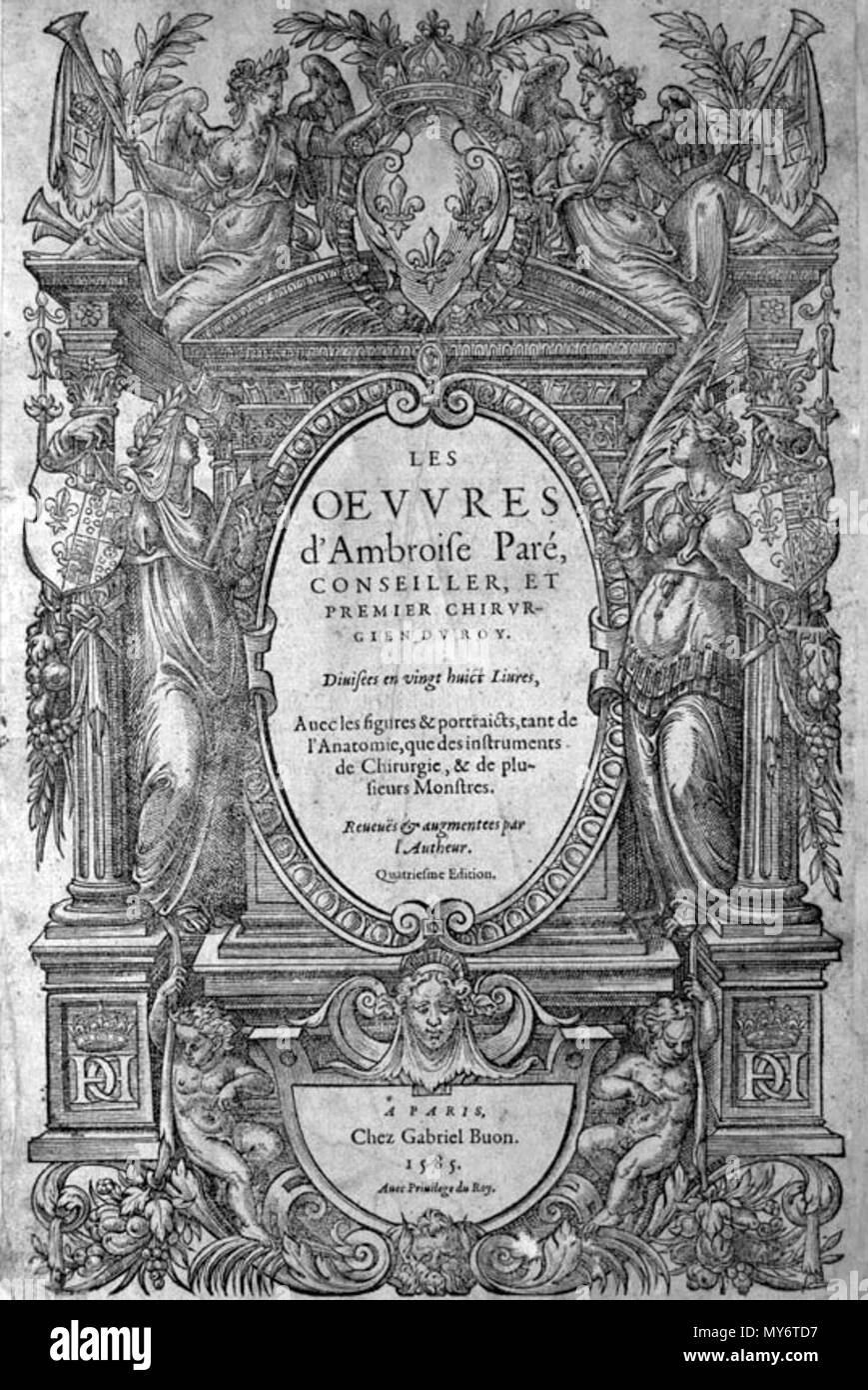 . Ambroise Paré (1510 ?-1590) : Les oeuvres d'Ambroise Paré, 1585 ...