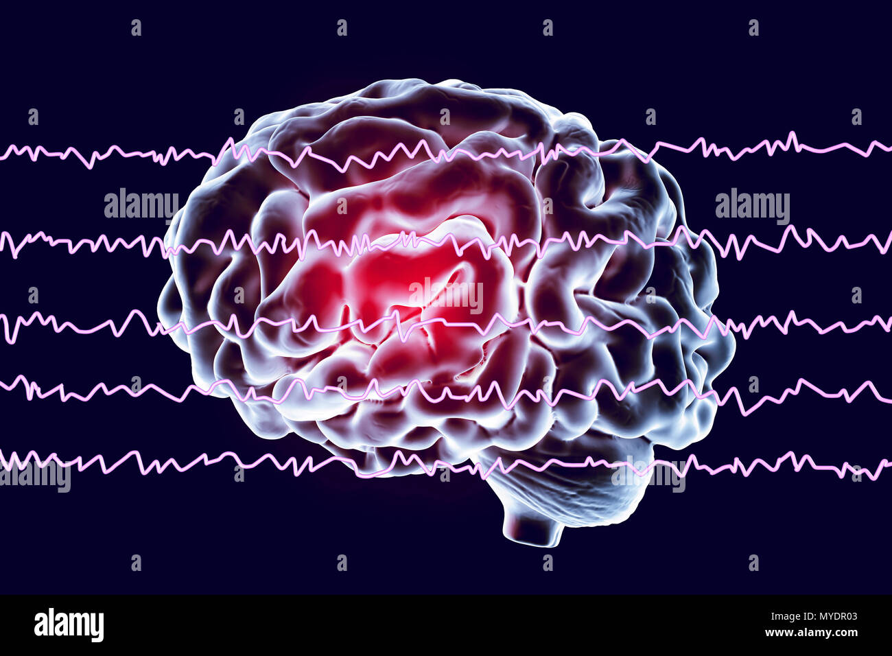 Eeg waves Banque de photographies et d’images à haute résolution - Alamy