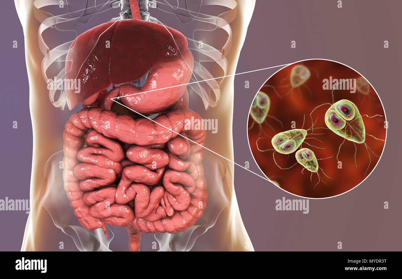 Giardia lamblia dans le duodénum, l'illustration de l'ordinateur ...