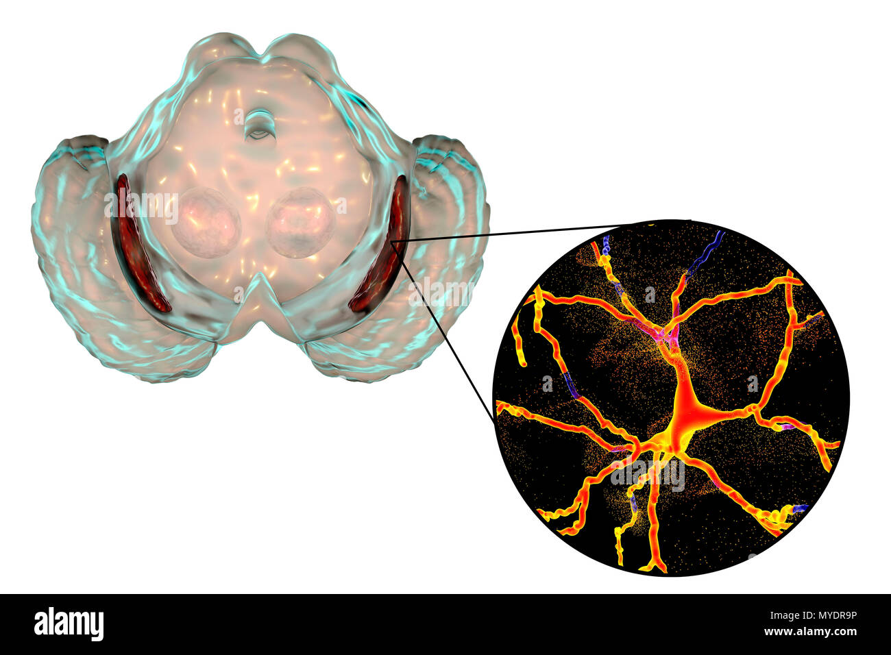 La substance noire dans la maladie de parkinson Banque de photographies ...