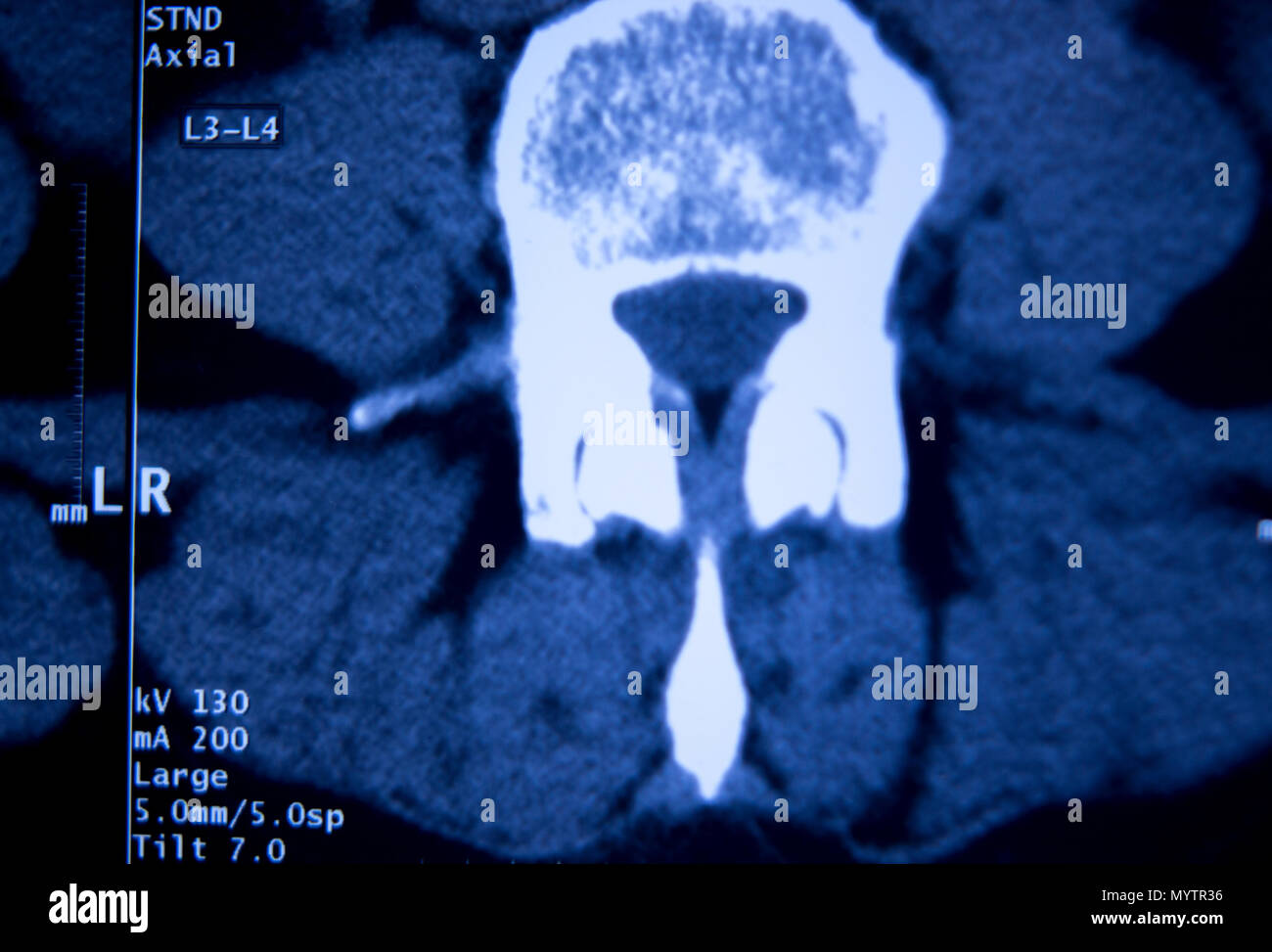 X-ray hôpital médical rachis bassin hanches traumatologie IRM scan ...