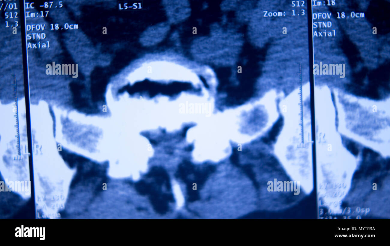 X-ray hôpital médical rachis bassin hanches traumatologie IRM scan ...