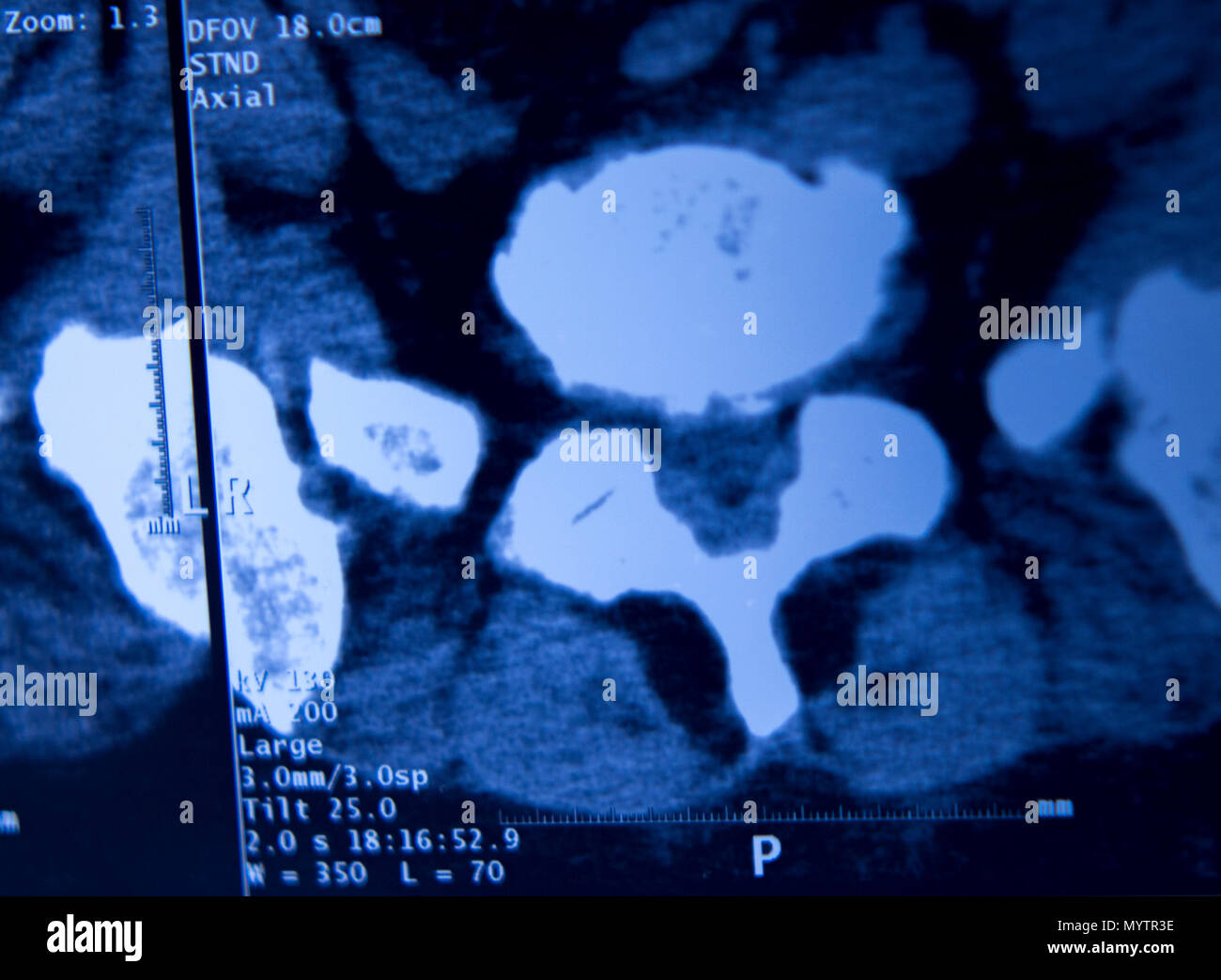 X-ray hôpital médical rachis bassin hanches traumatologie IRM scan ...