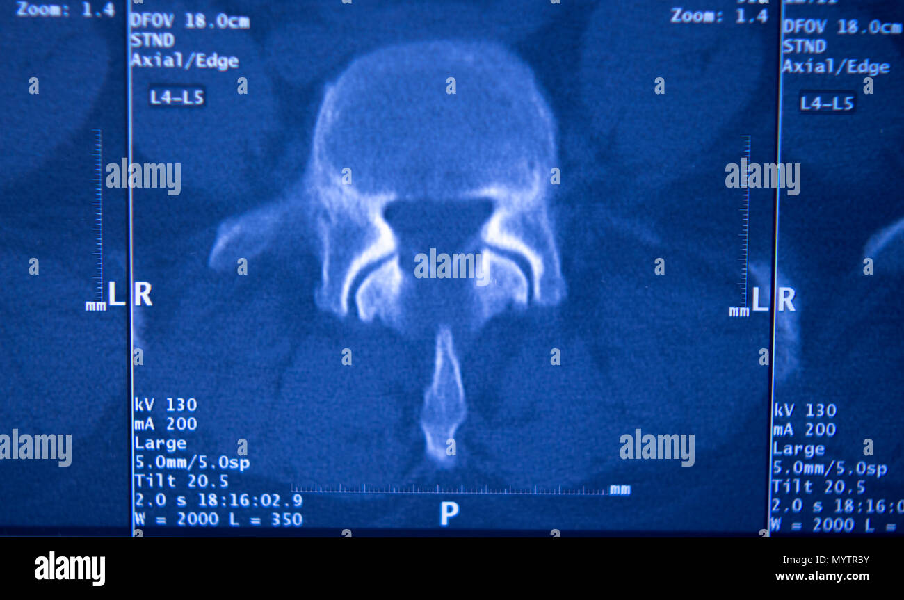 X-ray hôpital médical rachis bassin hanches traumatologie IRM scan ...