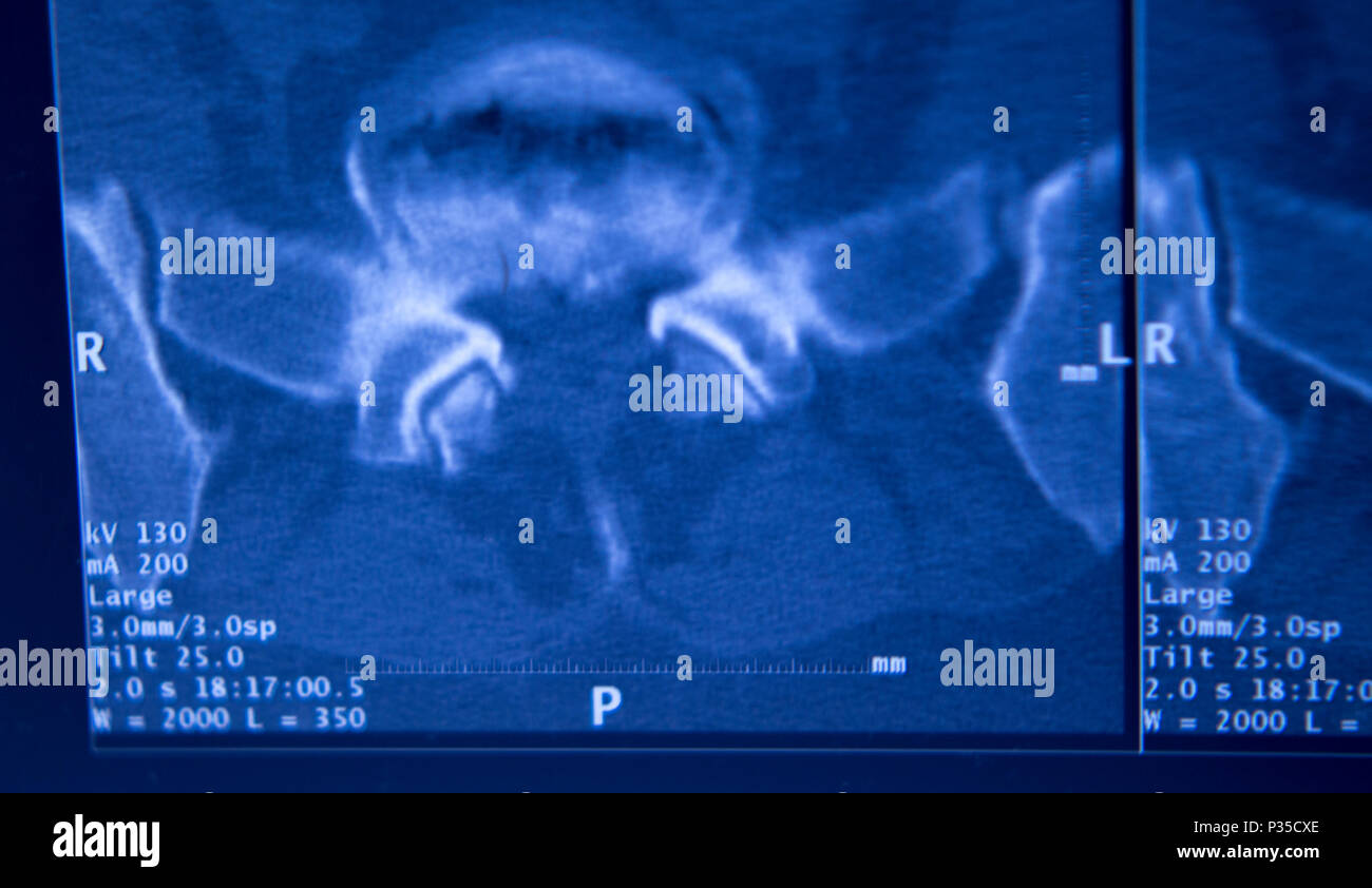 X-ray hôpital médical rachis bassin hanches traumatologie IRM scan ...