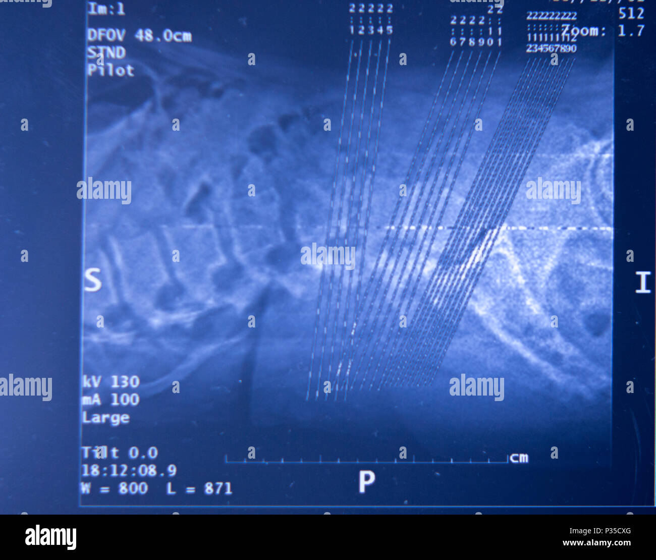 X-ray hôpital médical rachis bassin hanches traumatologie IRM scan ...