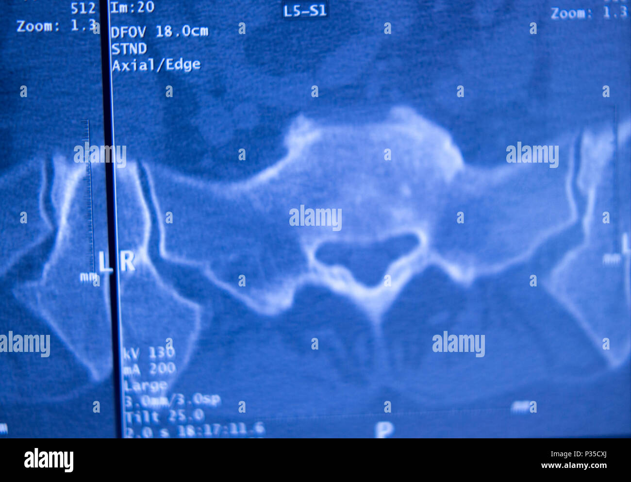 X-ray hôpital médical rachis bassin hanches traumatologie IRM scan ...