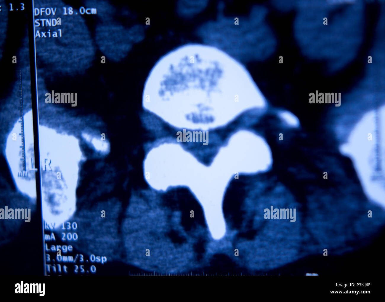 X-ray hôpital médical rachis bassin hanches traumatologie IRM scan ...