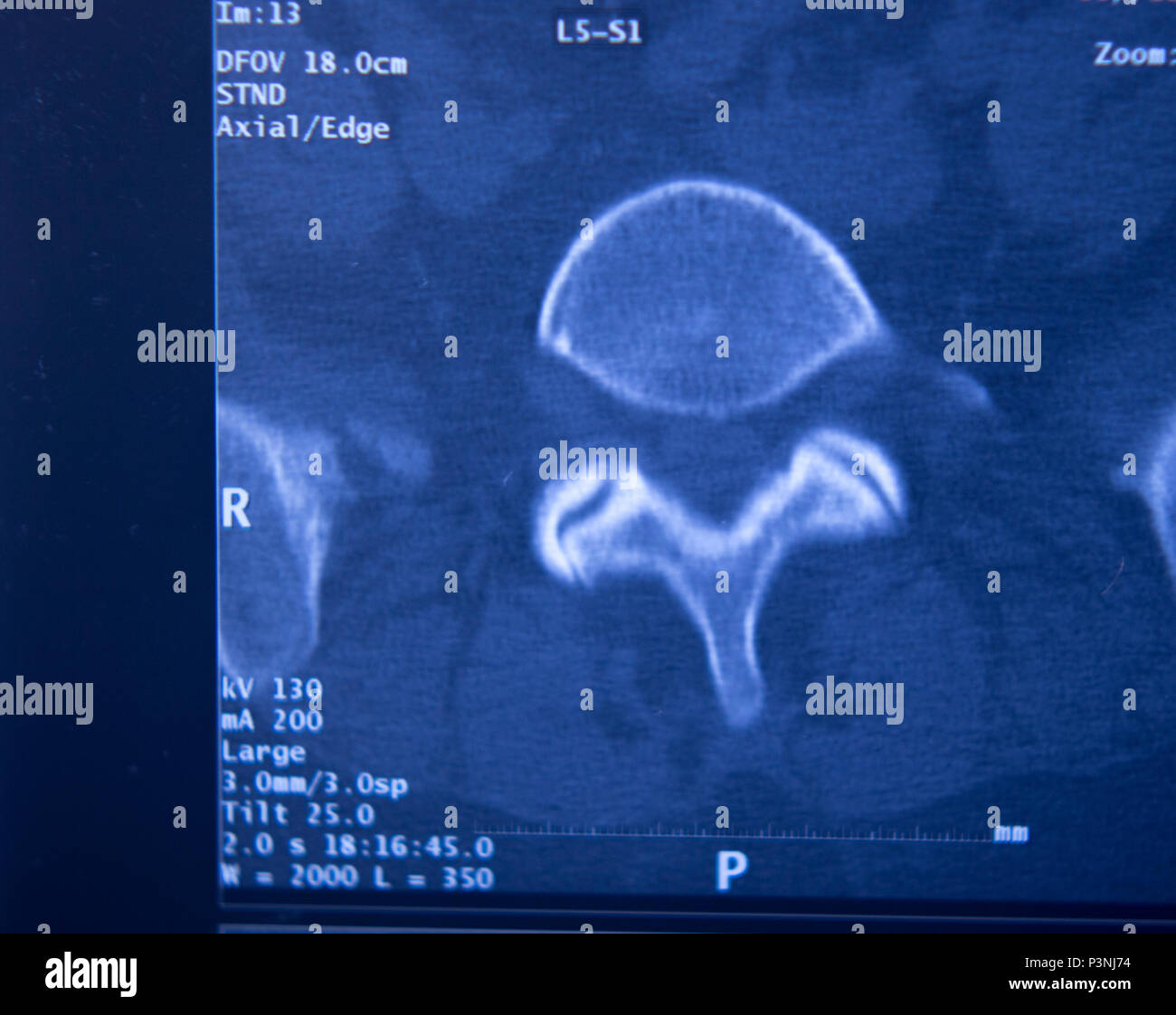 X-ray hôpital médical rachis bassin hanches traumatologie IRM scan ...