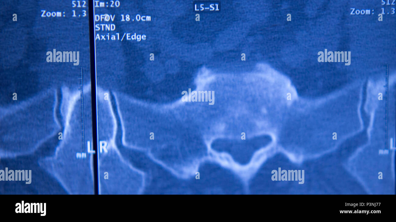 X-ray hôpital médical rachis bassin hanches traumatologie IRM scan ...