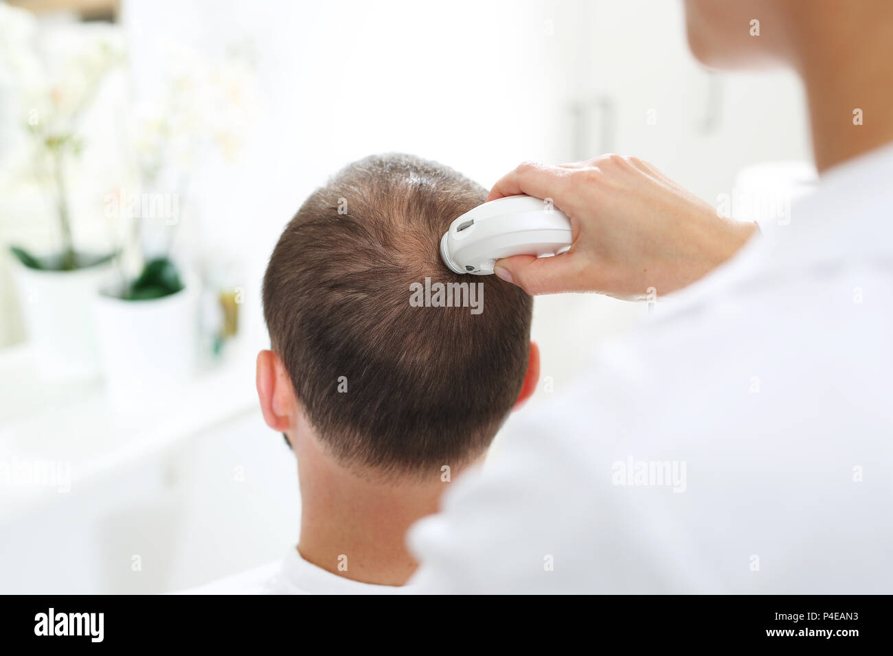 Analyse des cheveux. Examen trichologique. La tête d'un homme avec un ...