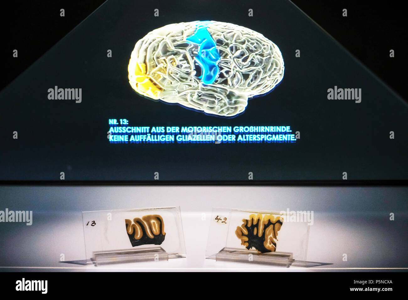 Deux sections histologiques du cerveau d'Albert Einstein (1879-1955) ci ...
