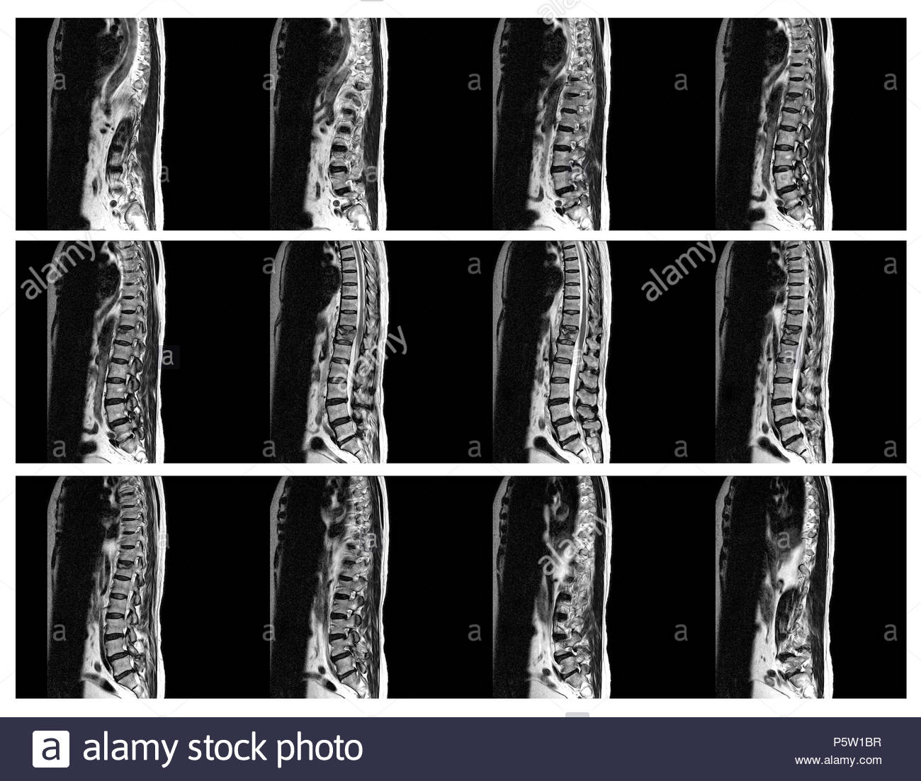 T12 Vertebra Photos & T12 Vertebra Images - Alamy