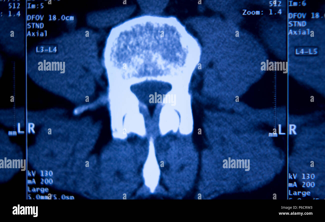 X-ray hôpital médical rachis bassin hanches traumatologie IRM scan ...