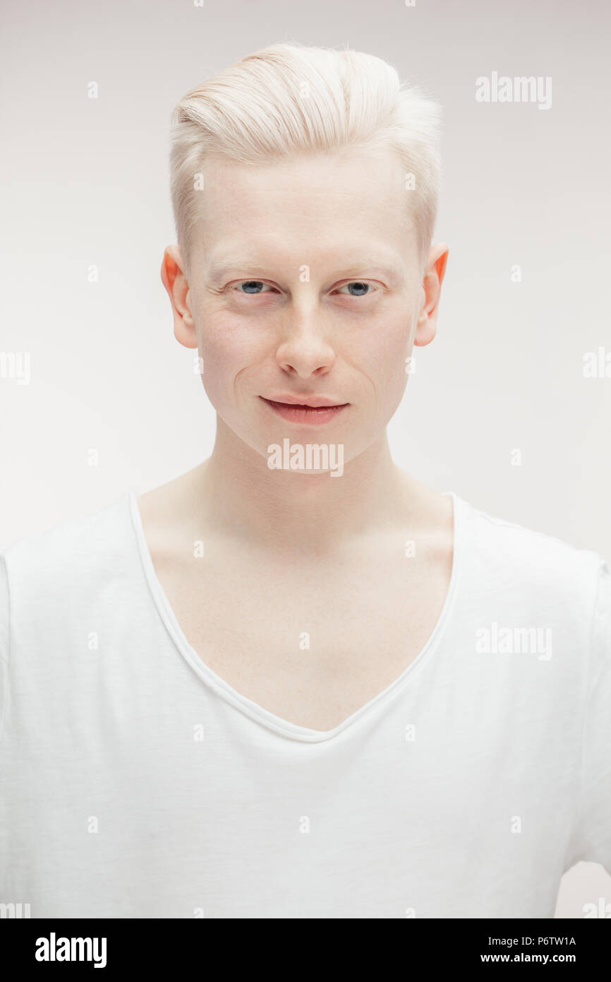 Albino model Banque de photographies et d’images à haute résolution - Alamy