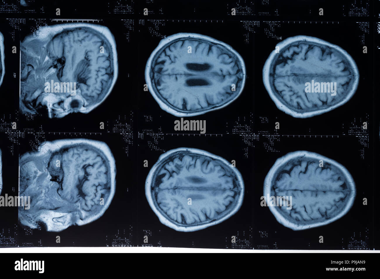 Radiografia computerizzata Banque de photographies et d’images à haute ...