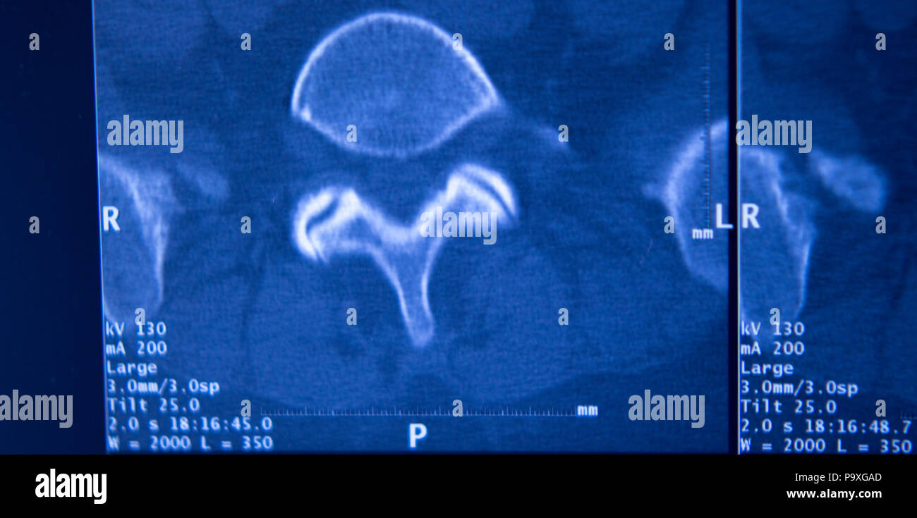 X-ray hôpital médical rachis bassin hanches traumatologie IRM scan ...