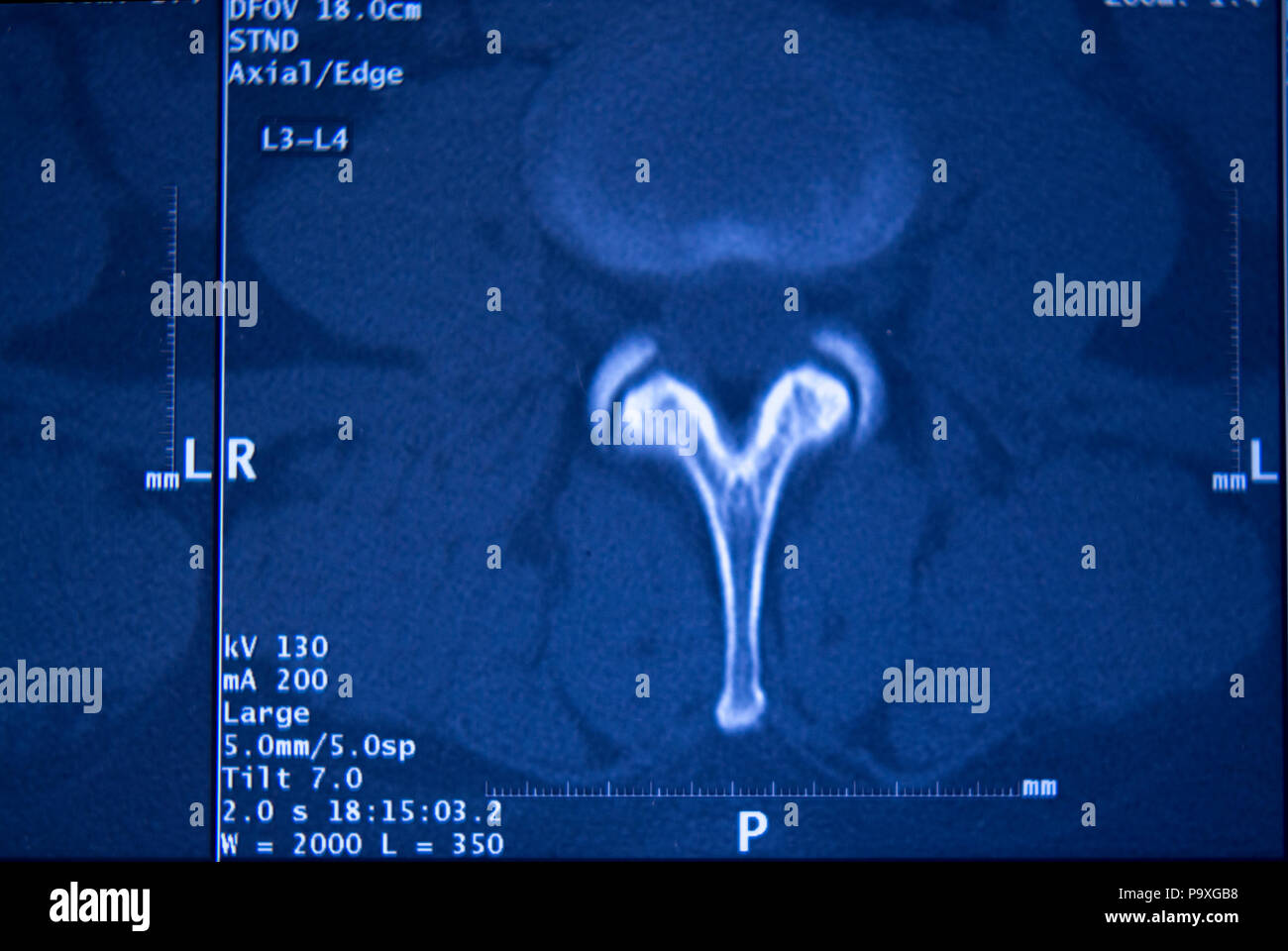 X-ray hôpital médical rachis bassin hanches traumatologie IRM scan ...