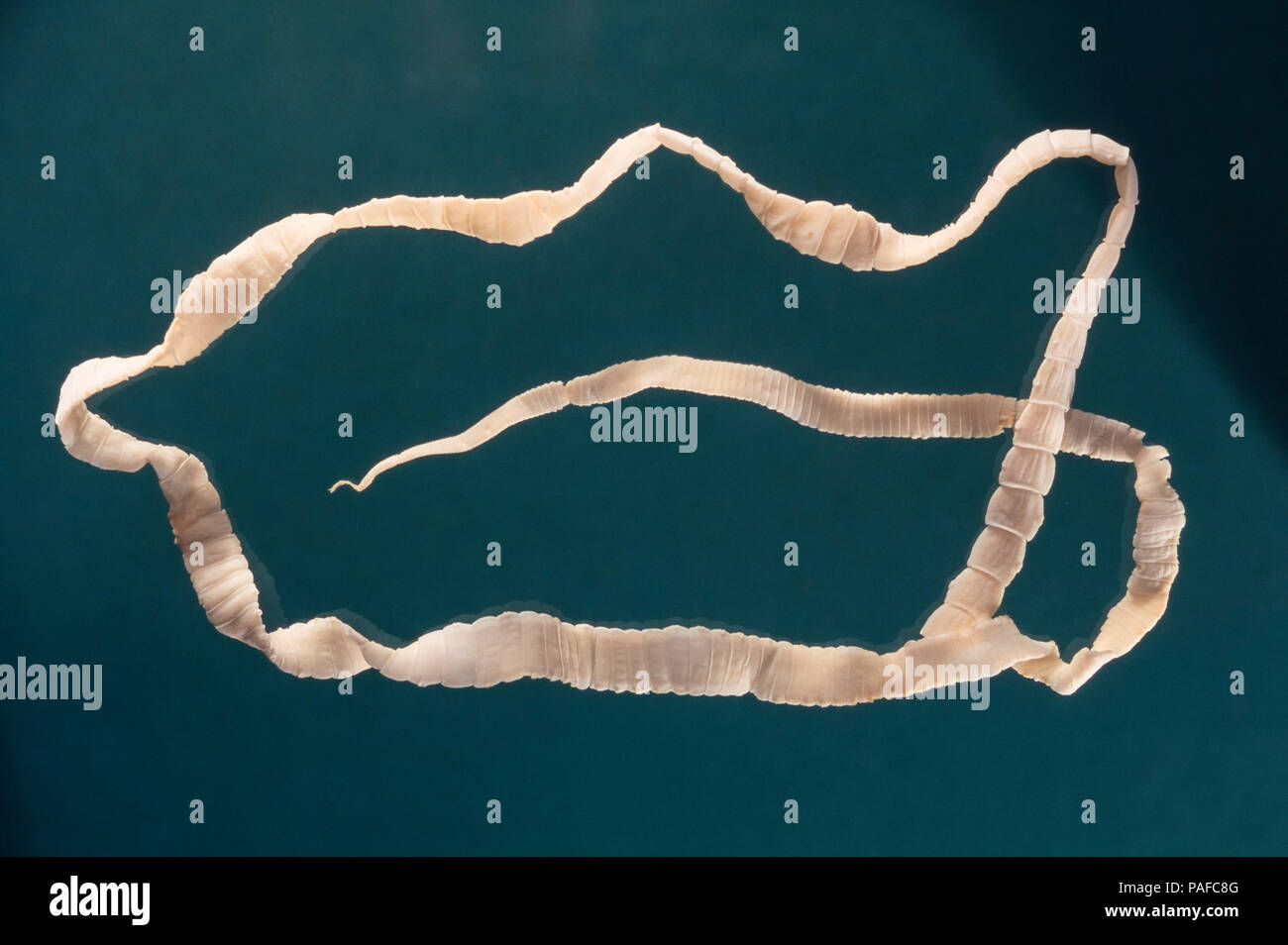 Parasite Humain Banque d'image et photos - Alamy