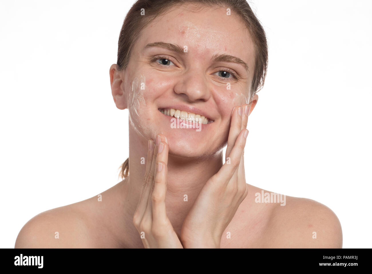 Tache Rouge Peau Sur Cicatrice Banque d'image et photos - Alamy