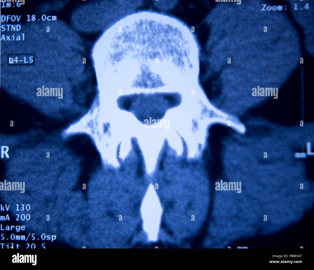 X-ray hôpital médical rachis bassin hanches traumatologie IRM scan ...