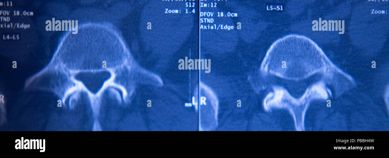 X-ray hôpital médical rachis bassin hanches traumatologie IRM scan ...