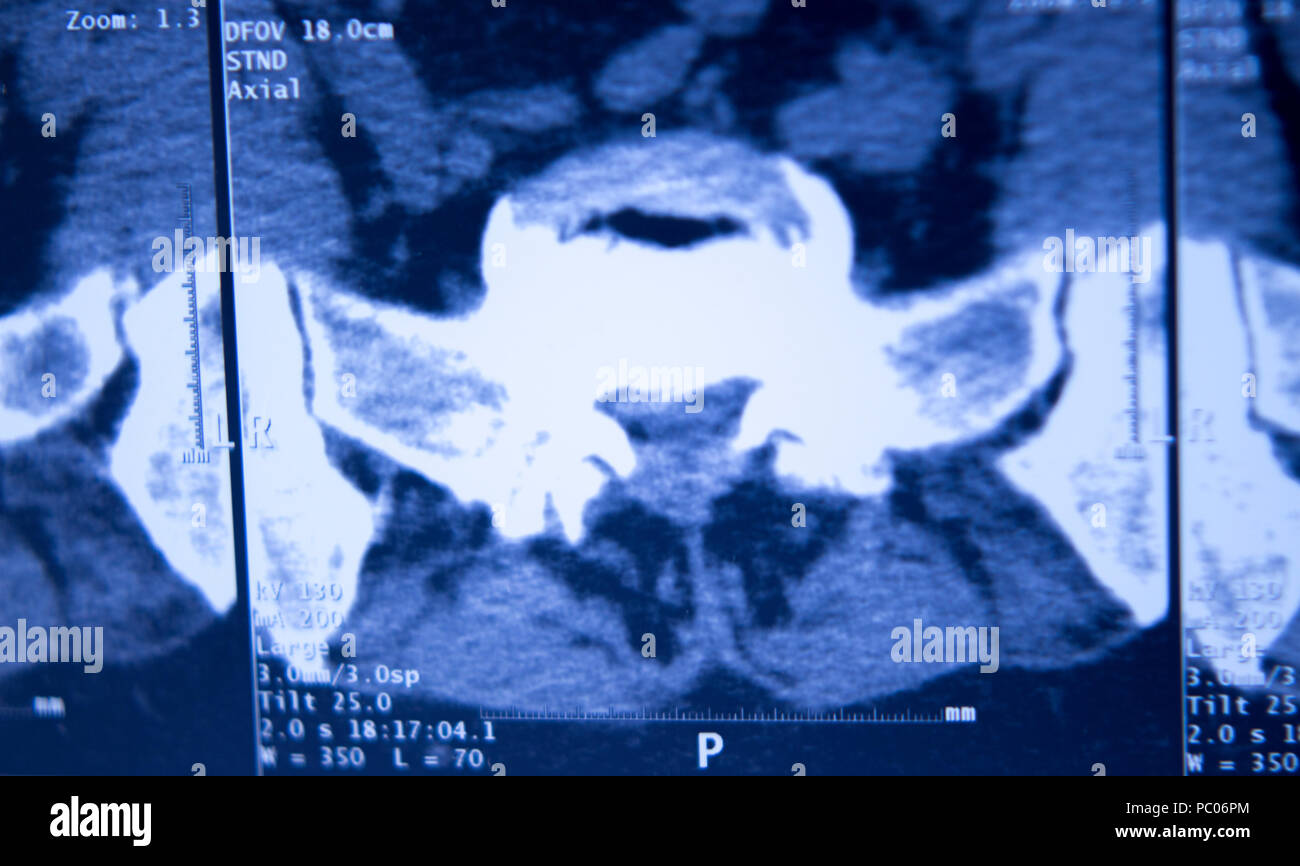 X-ray hôpital médical rachis bassin hanches traumatologie IRM scan ...