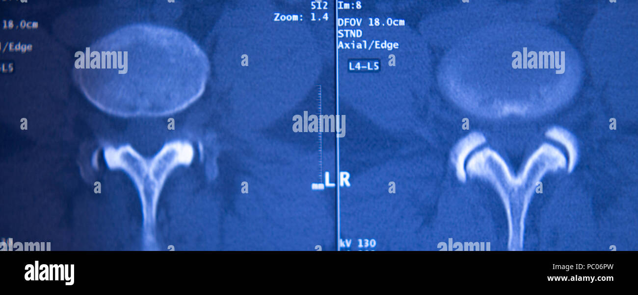 X-ray hôpital médical rachis bassin hanches traumatologie IRM scan ...