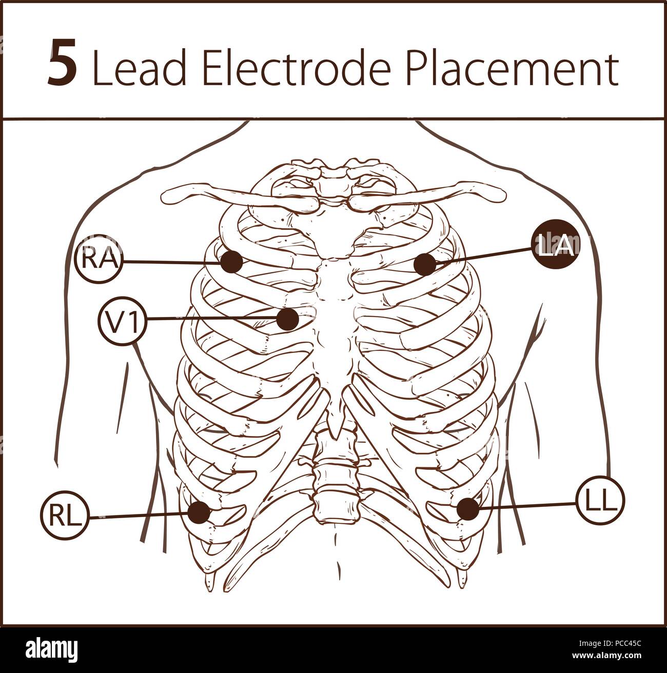 Ecg placement electrode Banque de photographies et d’images à haute ...