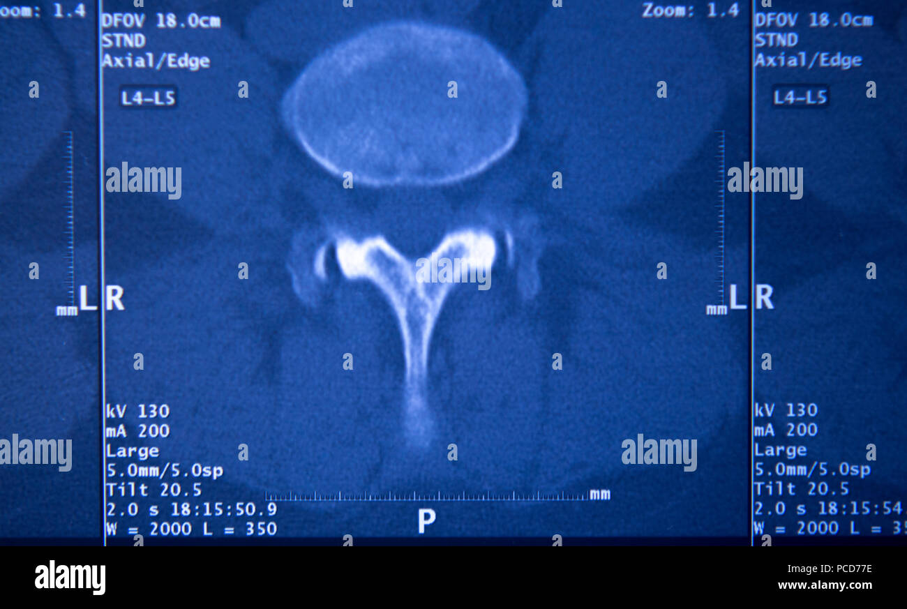 X-ray hôpital médical rachis bassin hanches traumatologie IRM scan ...