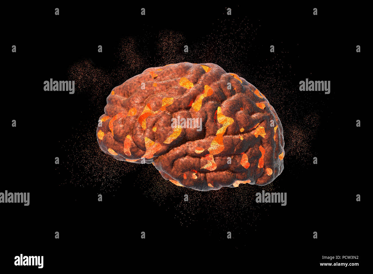 Cerveau qui explose Banque de photographies et d’images à haute ...