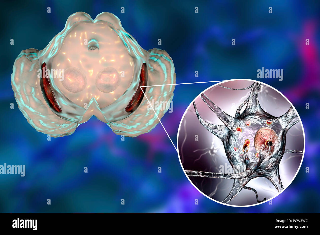 La substance noire dans la maladie de parkinson Banque de photographies ...