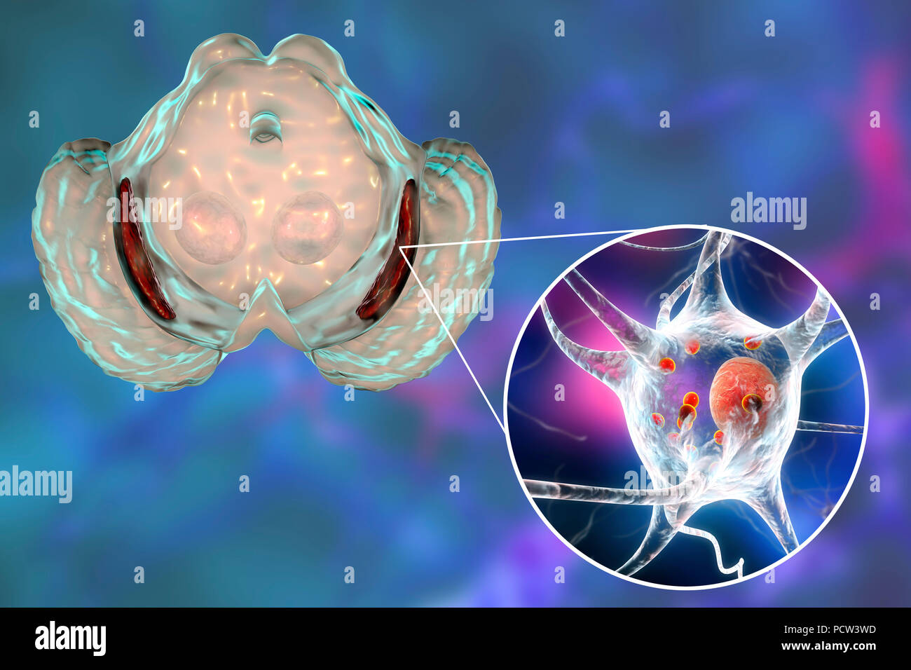 La substance noire dans la maladie de parkinson Banque de photographies ...