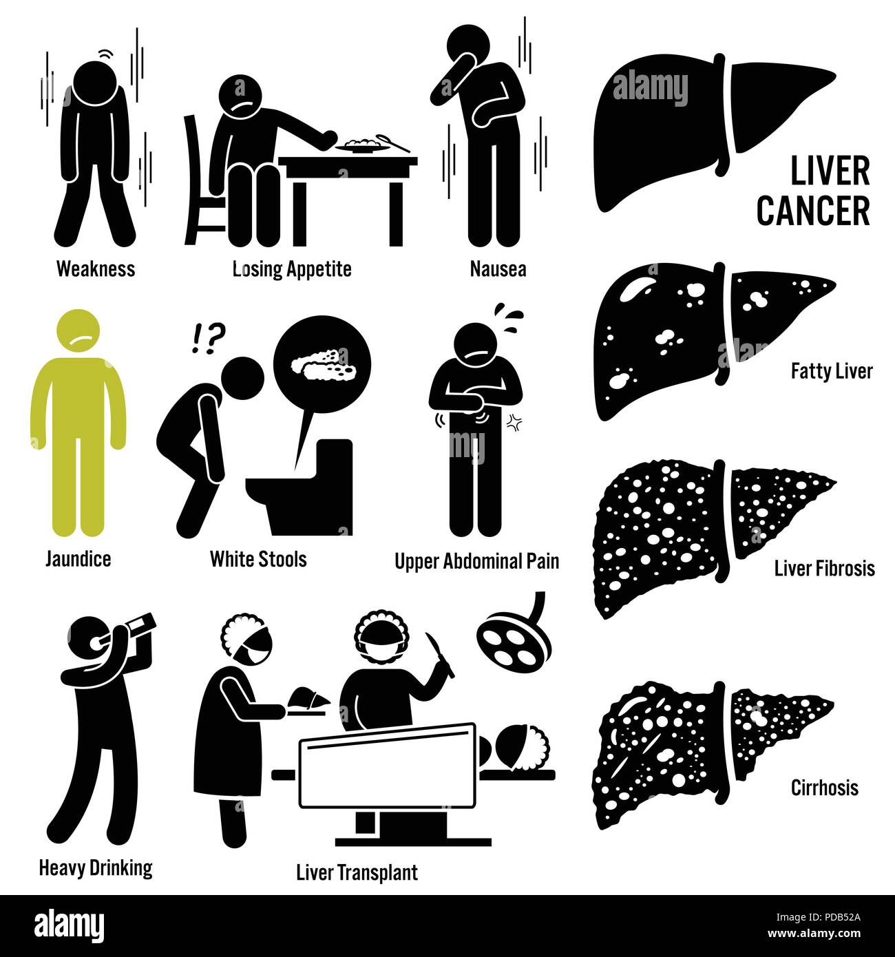 Cancer du foie Symptômes Causes Facteurs de risque Stick Figure Icônes ...