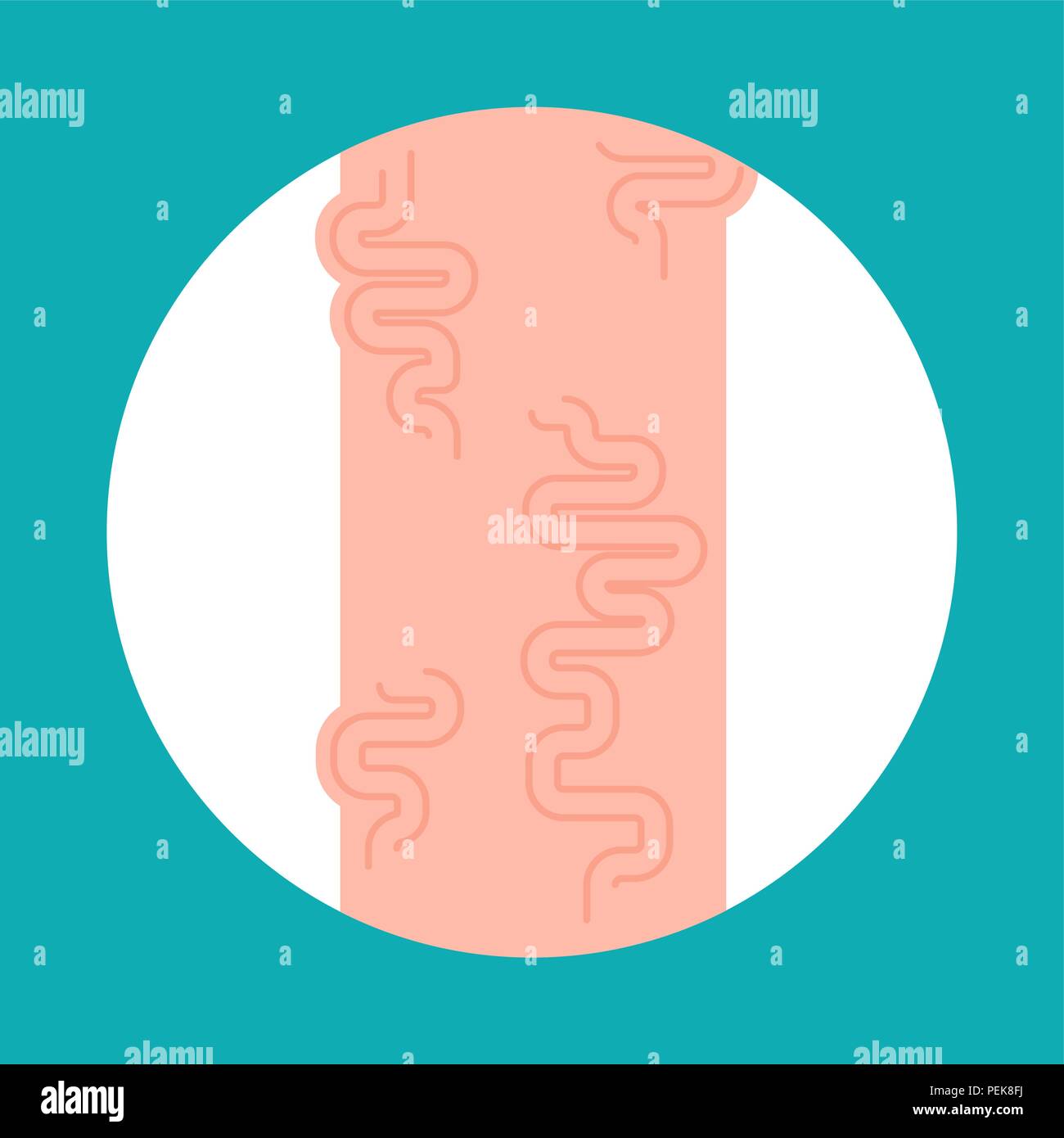 Les varices des jambes. Les maladies des veines du pied. Vector ...