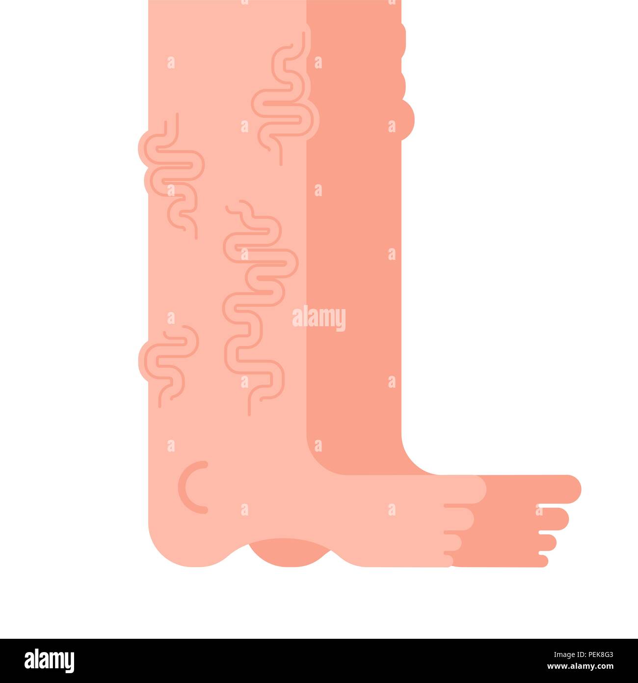 Jambes varices isolées. Les maladies des veines du pied. Vector ...