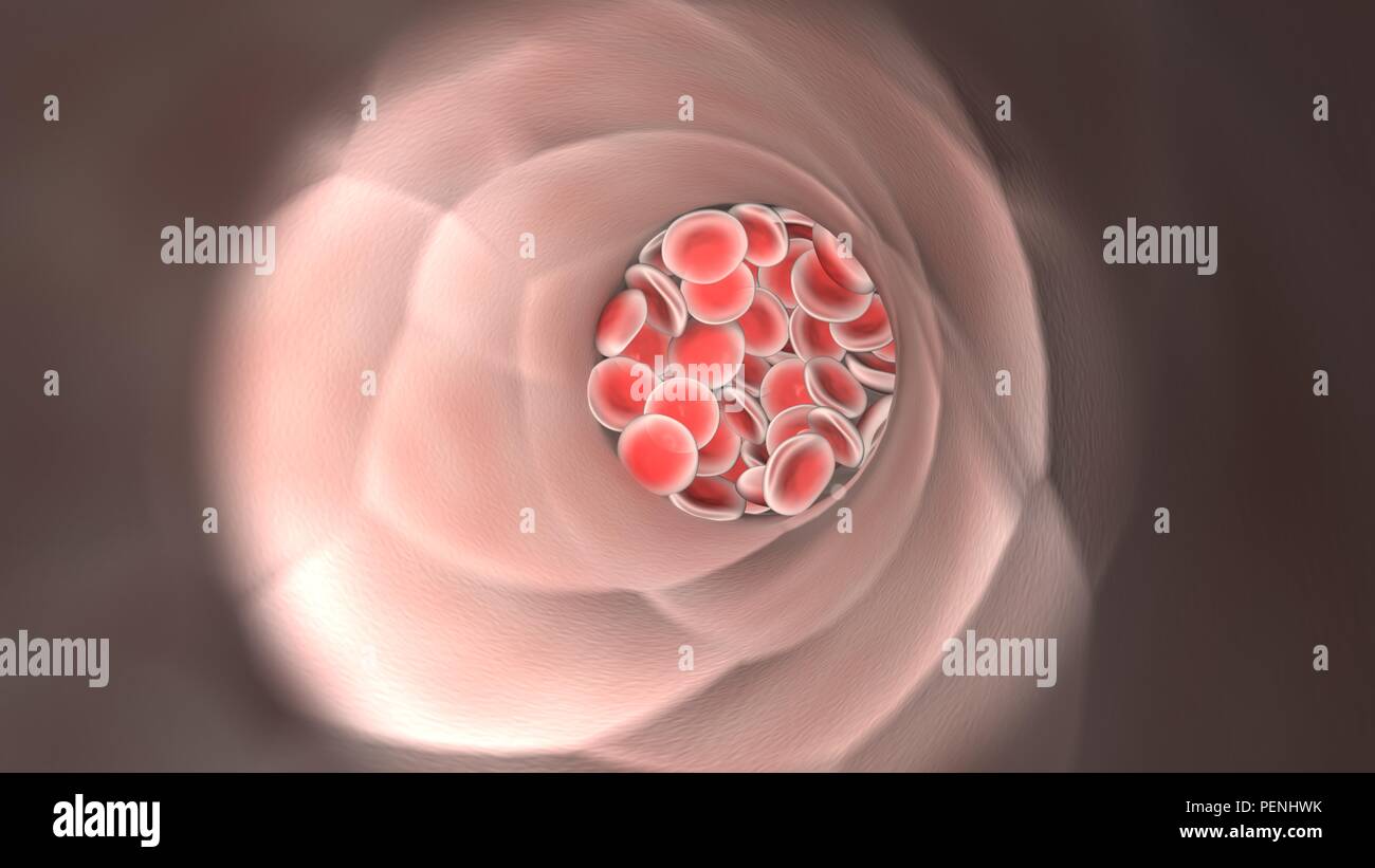 Caillot de sang dans une veine artère Banque de photographies et d ...