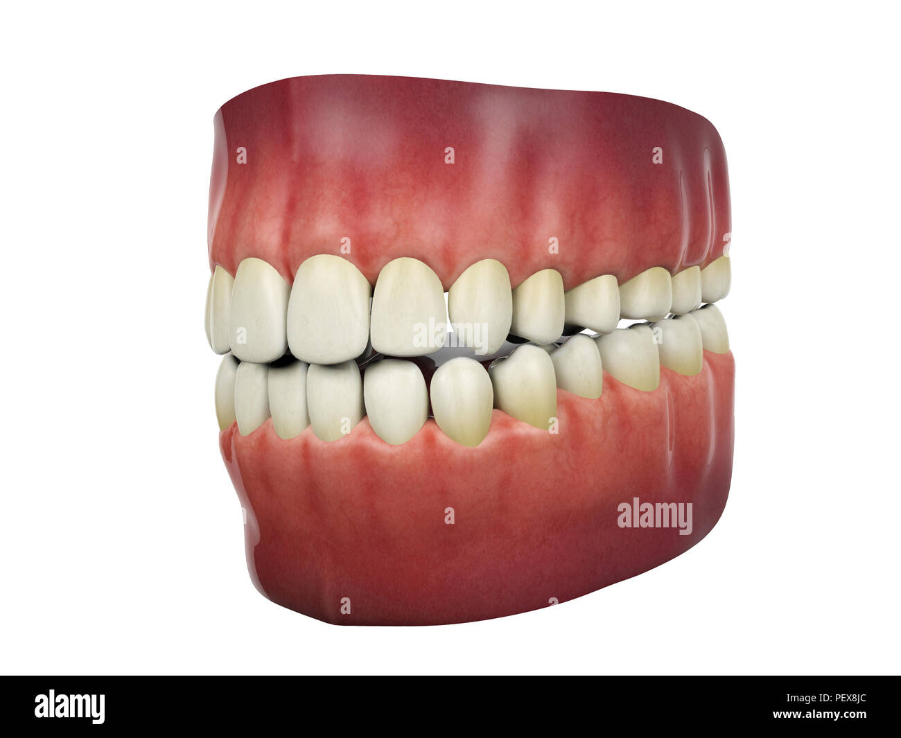 Anatomie dentaire 3d Banque de photographies et d’images à haute ...