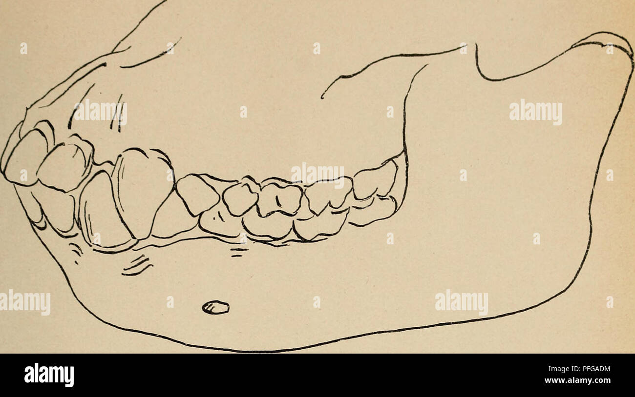 Cette étude anatomique comparative de la dentition humaine et ...