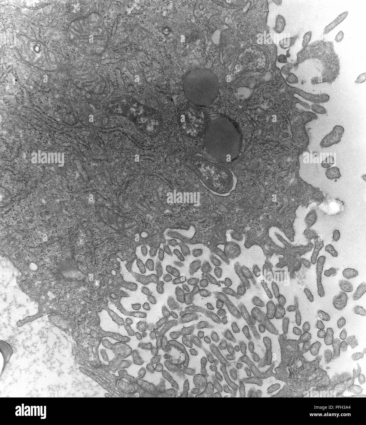 Cavité péritonéale Banque de photographies et d’images à haute ...