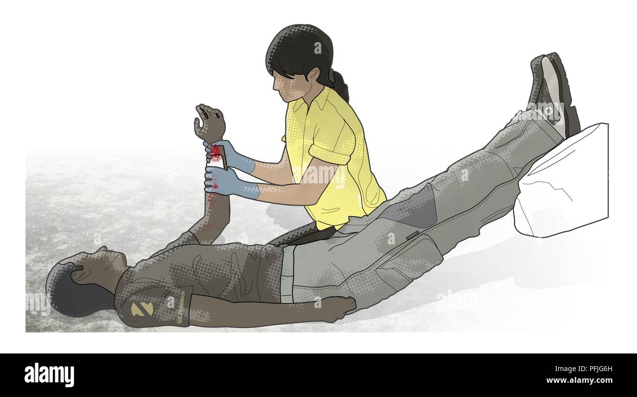 Control de la hemorragia Banque d'images détourées - Alamy