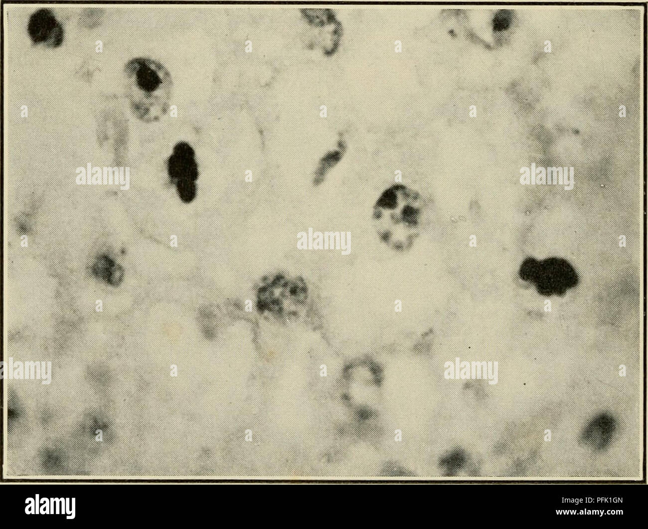 Chromosomes normaux Banque de photographies et d’images à haute ...