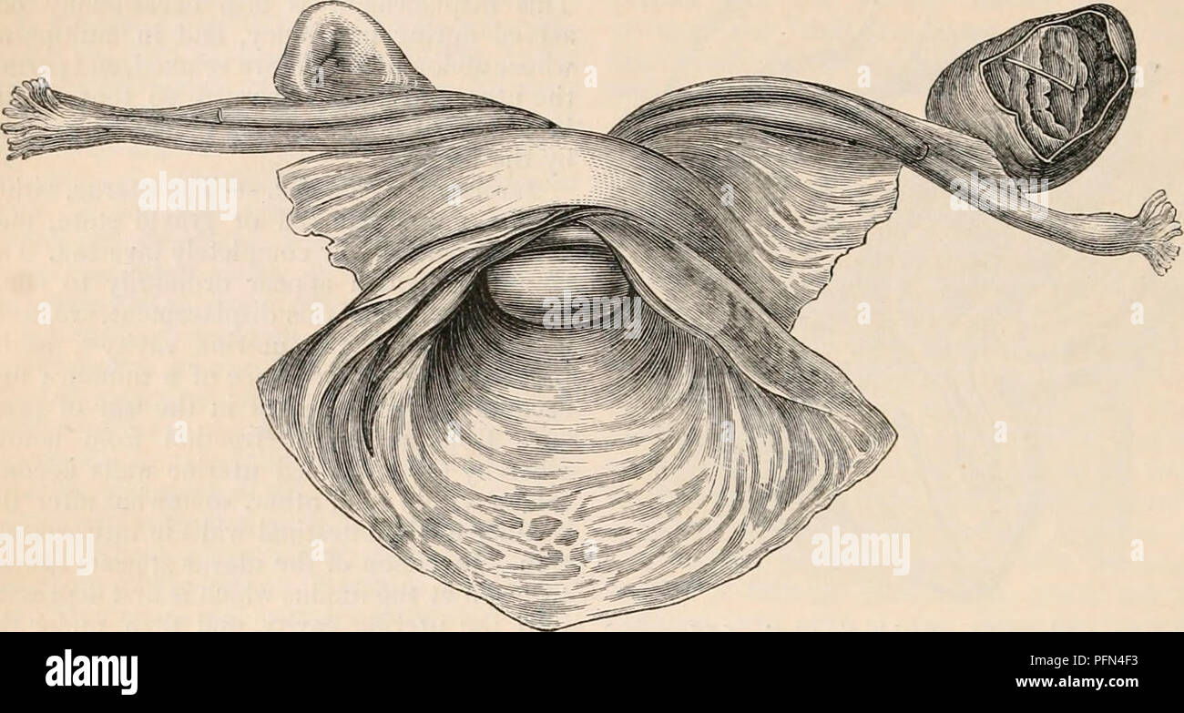 Fundus of uterus Banque de photographies et d’images à haute résolution ...