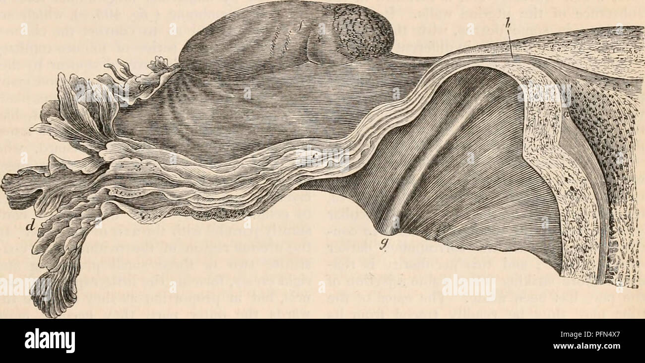 Péritonéal menbrane Banque de photographies et d’images à haute ...