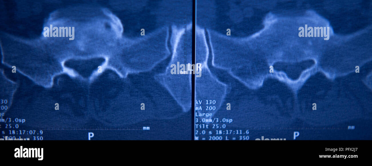 X-ray hôpital médical rachis bassin hanches traumatologie IRM scan ...